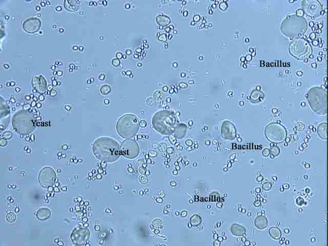 เริ่มเลี้ยงยีสต์ แต่เลี้ยงได้ 3 วัน ยีสต์ตาย ทำยังไงดีคะ - lemmemore