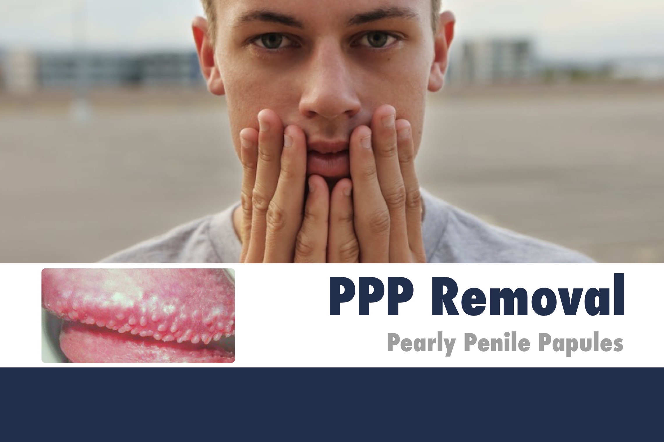 รักษาผื่นนูนพีพีพี PPP Removal (Pearly Penile Papules) - cmcwellbeing