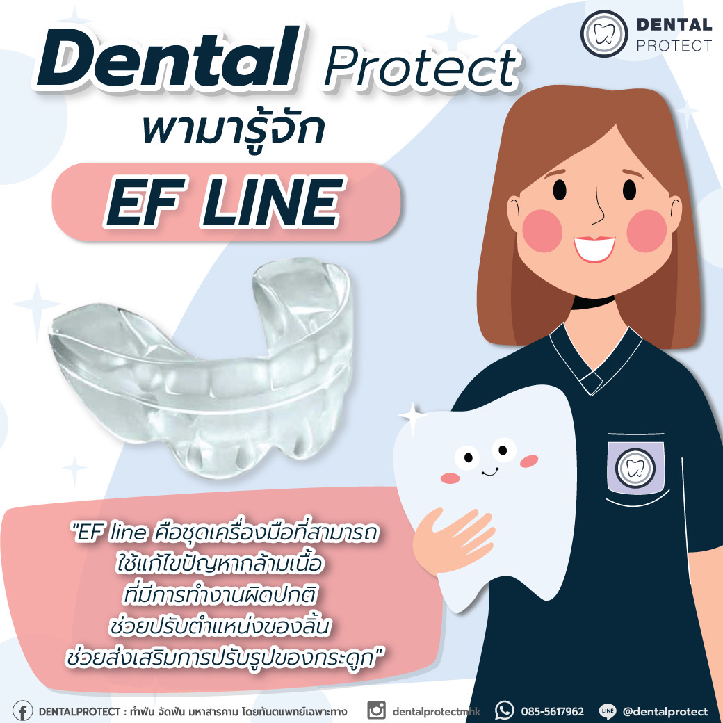 EF Line คืออะไร? l คลินิกทันตกรรมเดนทัลโพรเทค มหาสารคาม - dentalprotectmhk