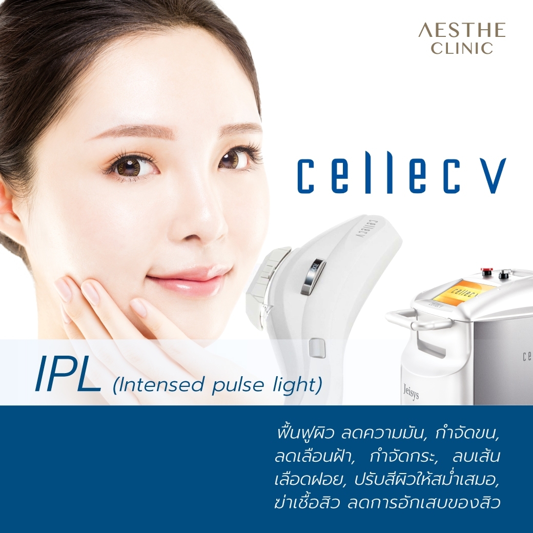 Cellec V IPL Treatment - aestheclinicthailand