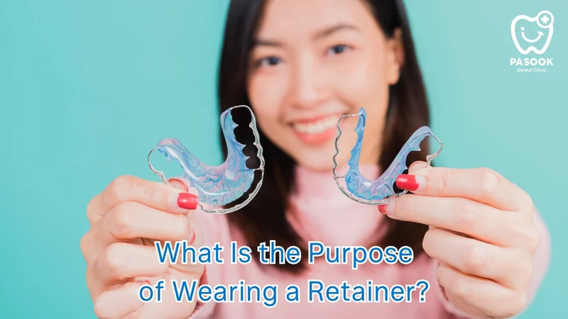 Retainers: The Unsung Hero of Orthodontic Treatment You Shouldn’t Ignore