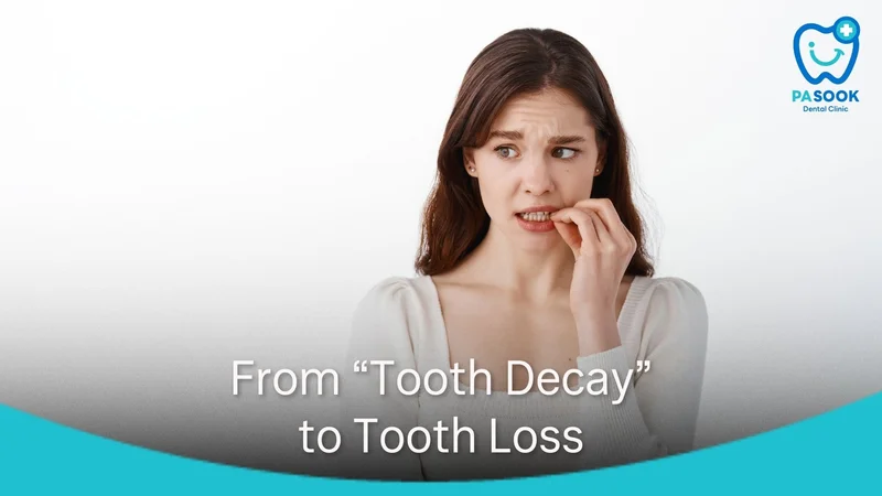 From Tooth Decay to Tooth Loss: How to Prevent and Treat It Effectively