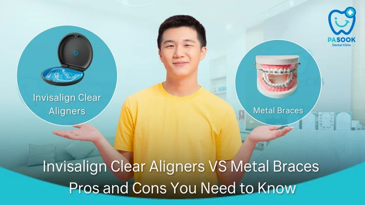 Invisalign Clear Aligners vs Metal Braces