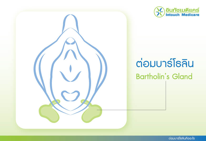 What causes a female genital abscess in Bartholin's glands? - intouchmedicare