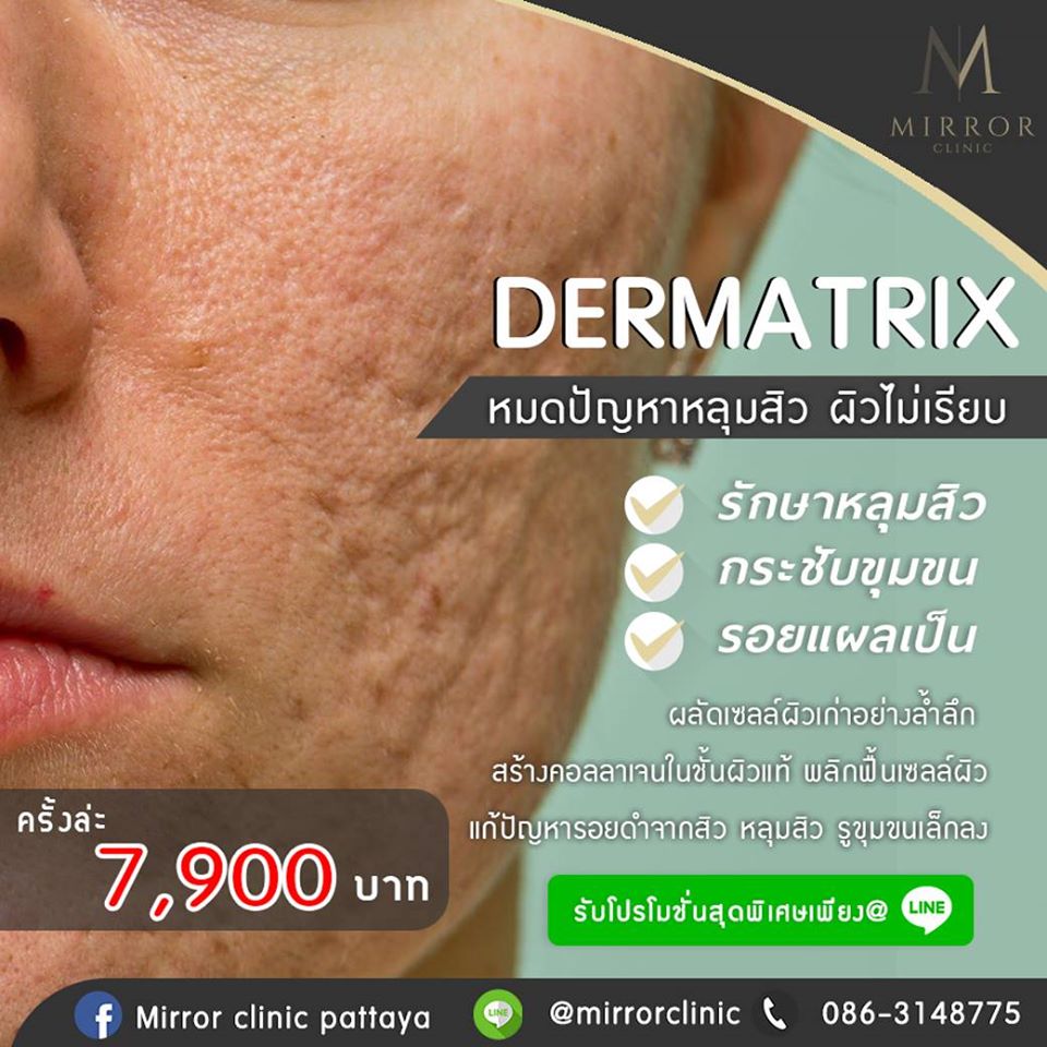 dermatrix - mirrorclinicpattaya