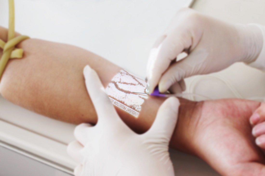 Projection Vein Finder -VEINCAS V800 series - daasia