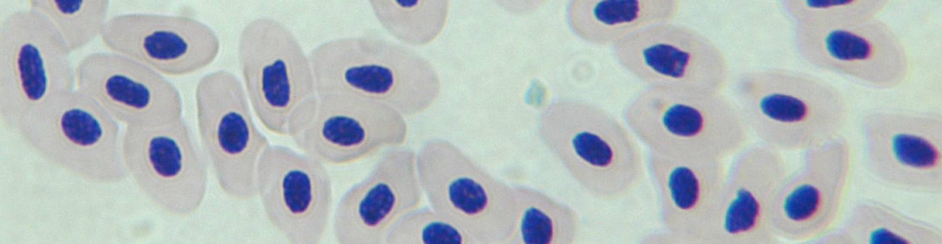 Automated / Manual Digital Microscopes - siammicroscope