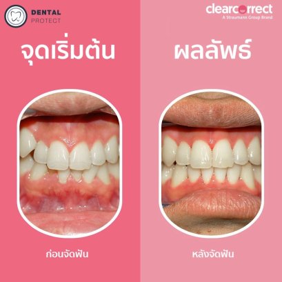 บทความทั้งหมด - dentalprotectmhk
