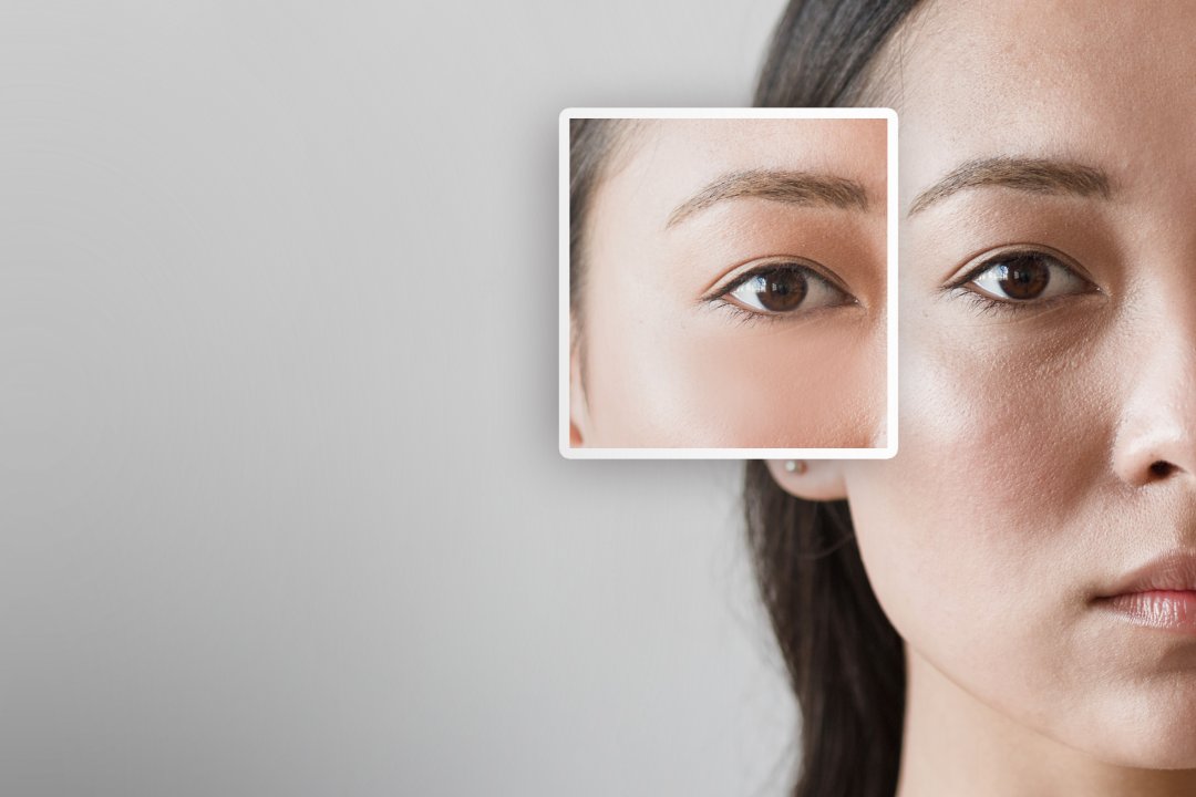 AESWELL CLINIC ศูนย์รักษาหลุมสิว ฝ้า กระ รอยดำ ลาซาล-แบริ่ง