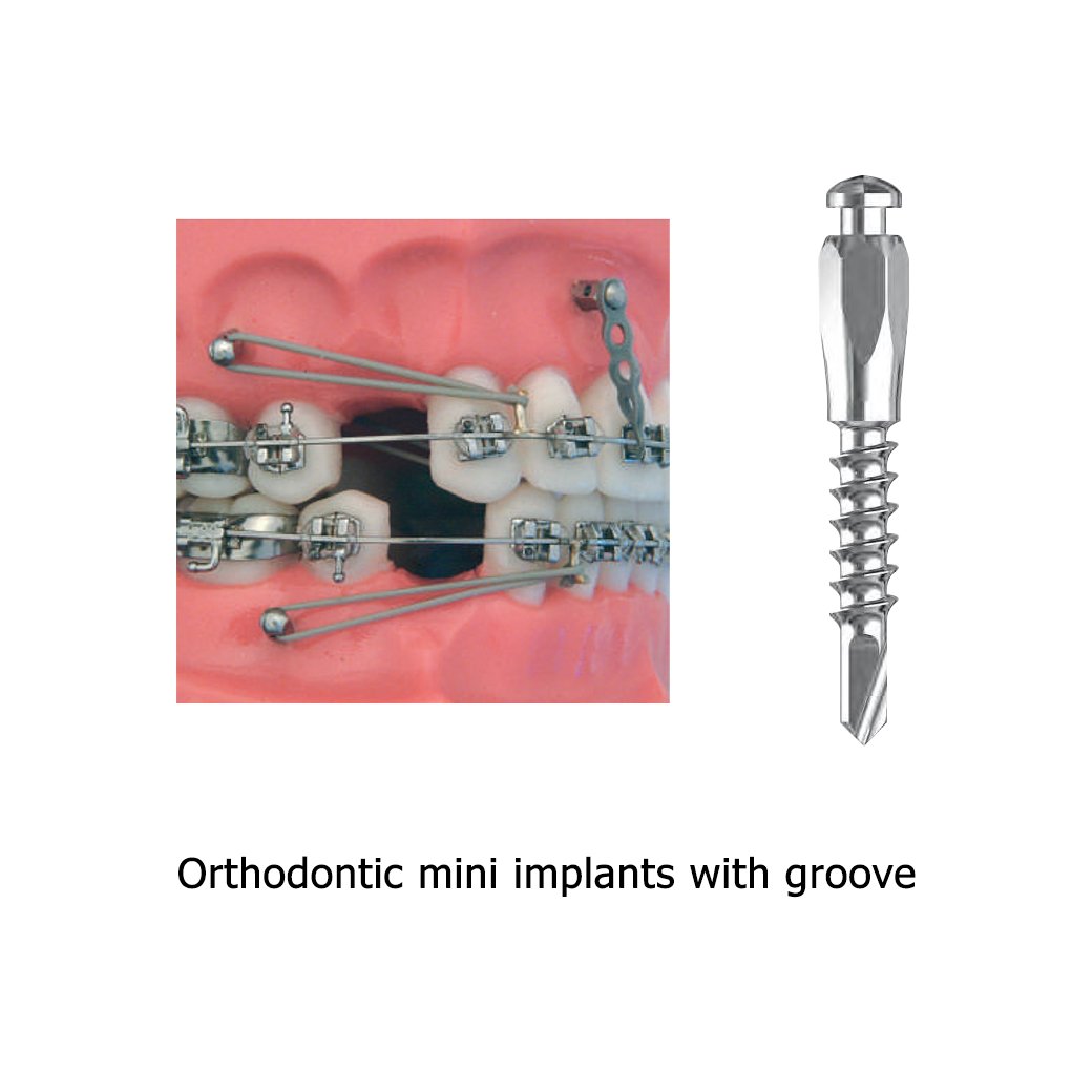 ORTHODONTIC MINI IMPLANTS WITH GROOVE