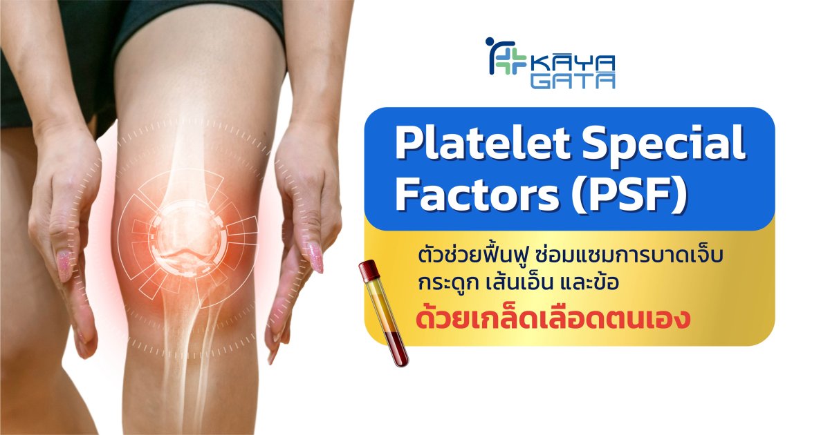 PSF ตัวช่วยฟื้นฟู ซ่อมแซมการบาดเจ็บกระดูก เส้นเอ็น และข้อ ด้วยเกล็ดเลือดตนเอง