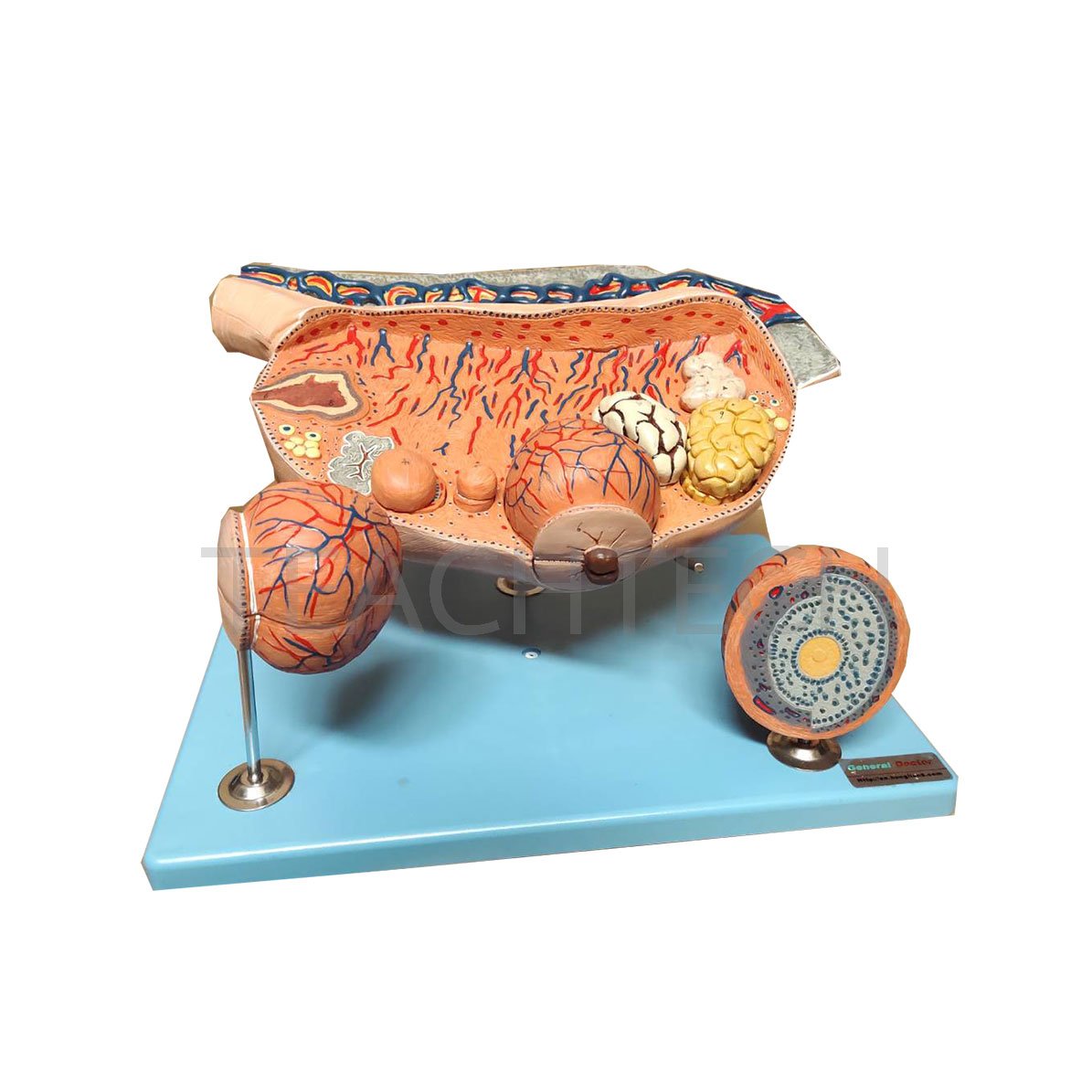(Ovary Model)##