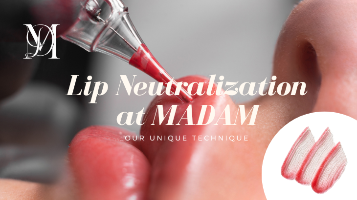 Lip Neutralization at MADAM: Our Unique Technique