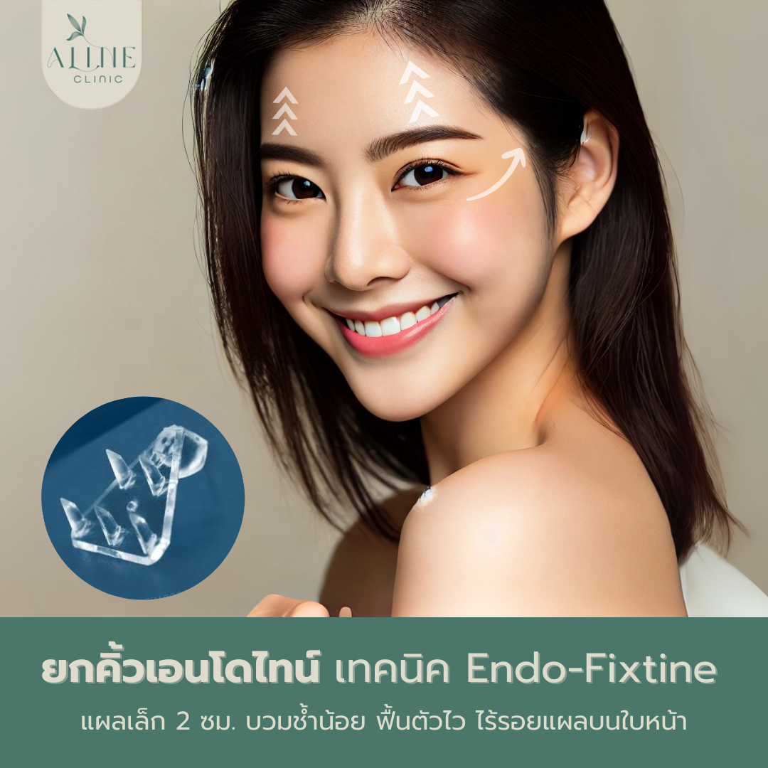 ยกคิ้วเอนโดไทน์ (Endotine Brow Lift) ศัลยกรรมยกคิ้วให้ดูอ่อนเยาว์ ตึง ...