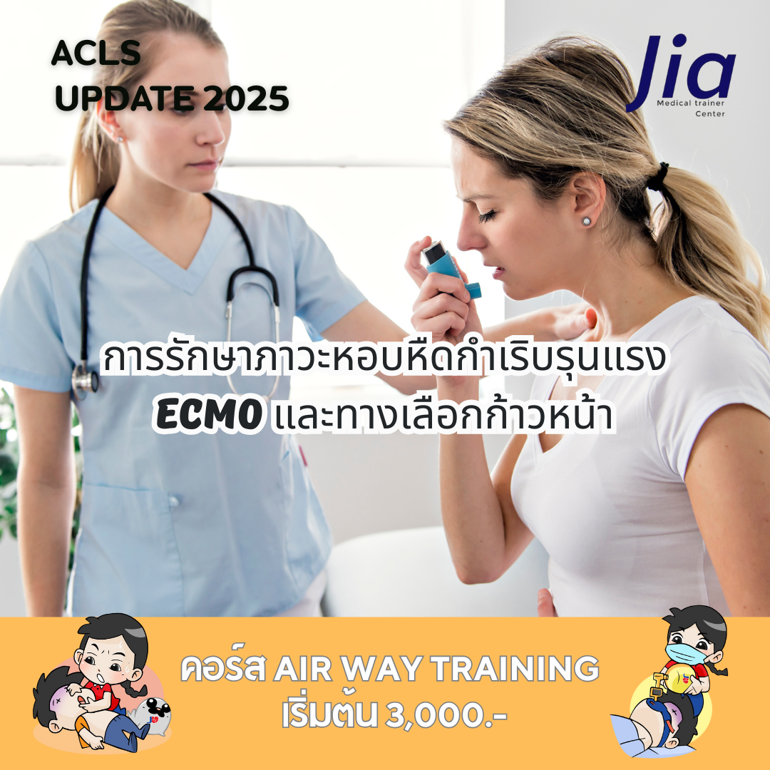 การรักษาภาวะหอบหืดกำเริบรุนแรง ECMO และทางเลือกก้าวหน้า?