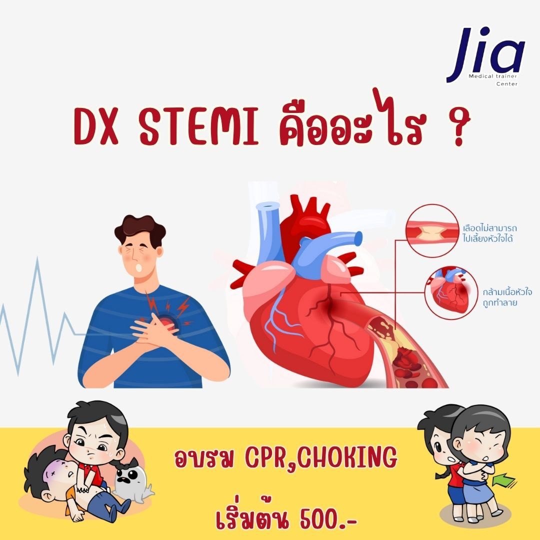 คำถามตอบแพทย์ : Dx STEMI คือ