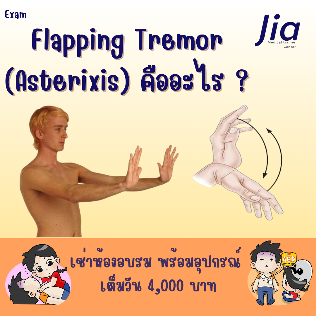 Flapping Tremor (Asterixis) คือ