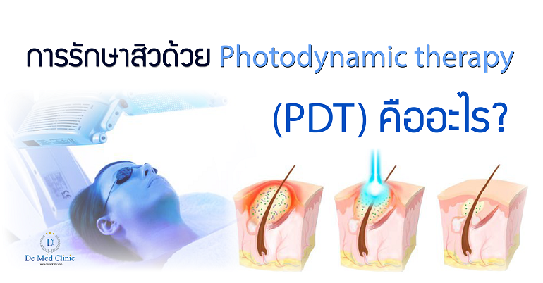 การรักษาสิวด้วย Photodynamic therapy (PDT) คืออะไร? - demedclinic