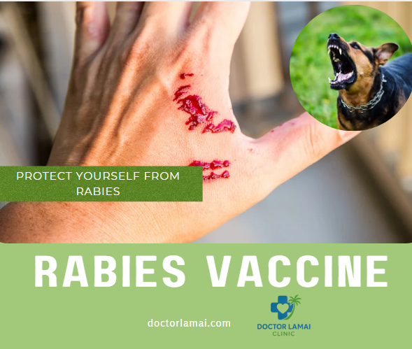 Rabies Vaccine for Humans: What It Is and Why It's Vital
