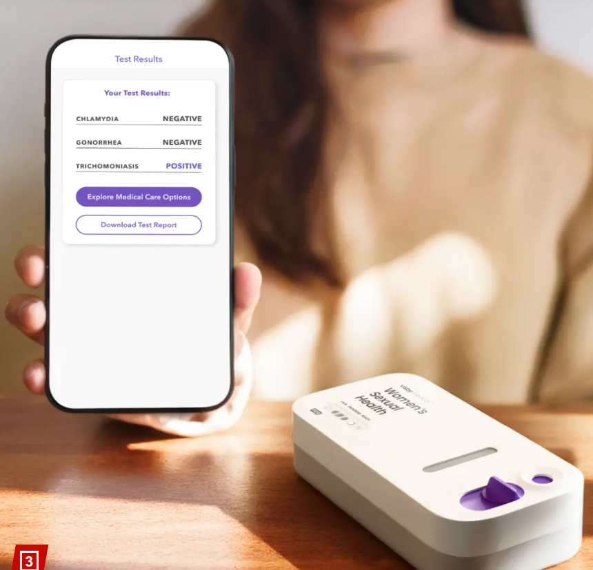Positive STD Test Results: Your Immediate Action Plan & Next Steps (2026)