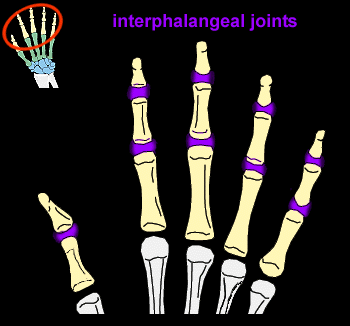 โรคนิ้วล็อก Trigger Finger