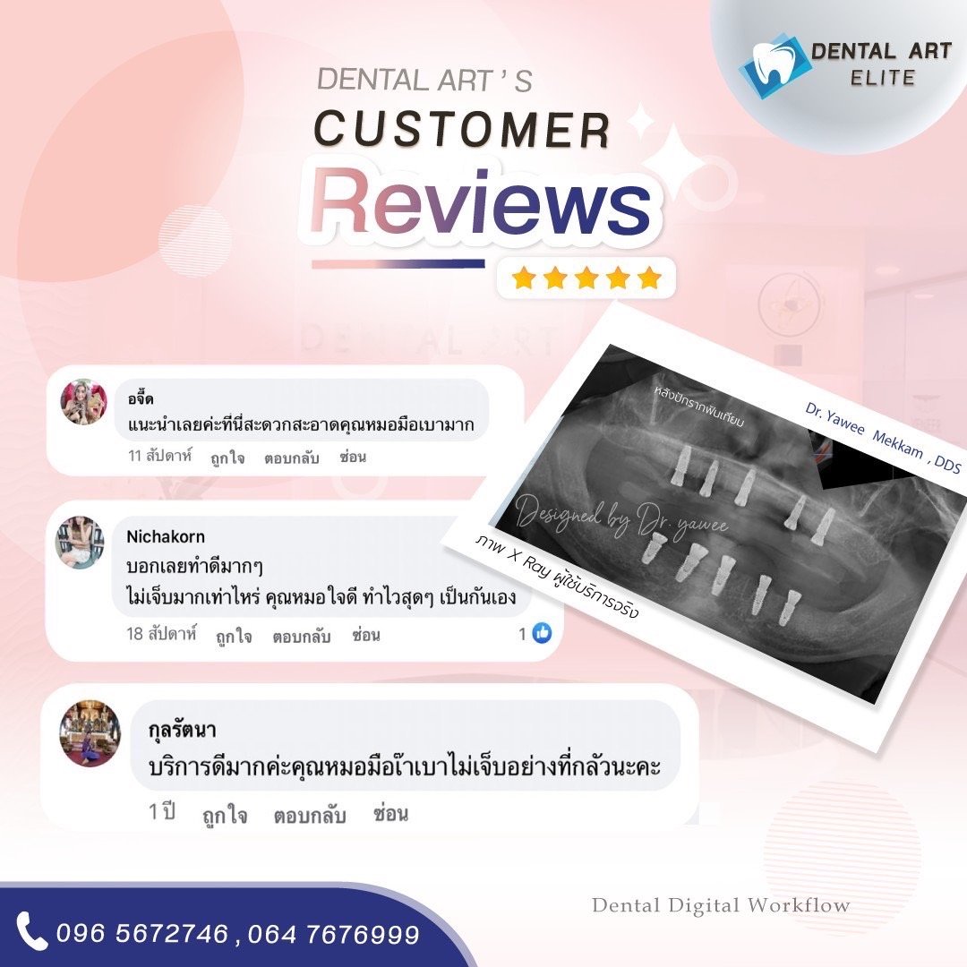 ศูนย์รากฟันเทียม จัดฟันฟันใส invisalign Dental Art Elite