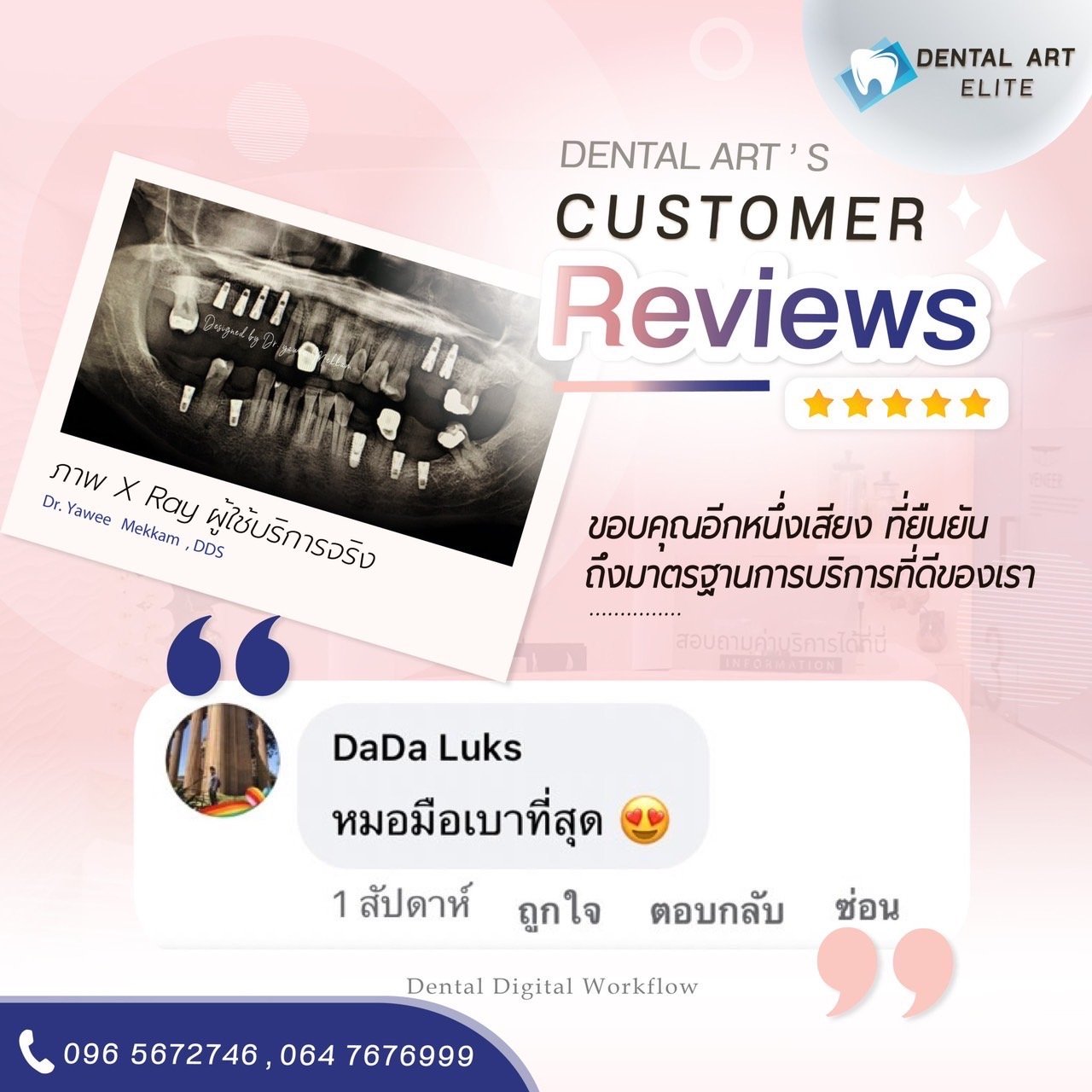 ศูนย์รากฟันเทียม จัดฟันฟันใส invisalign Dental Art Elite