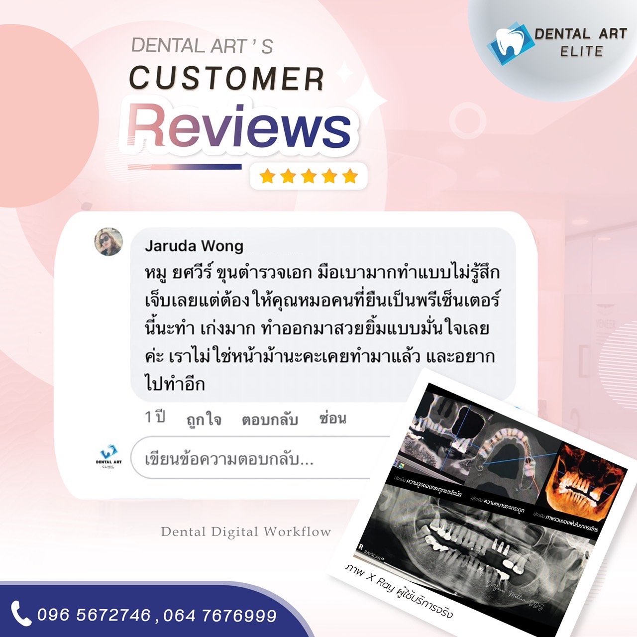 ศูนย์รากฟันเทียม จัดฟันฟันใส invisalign Dental Art Elite