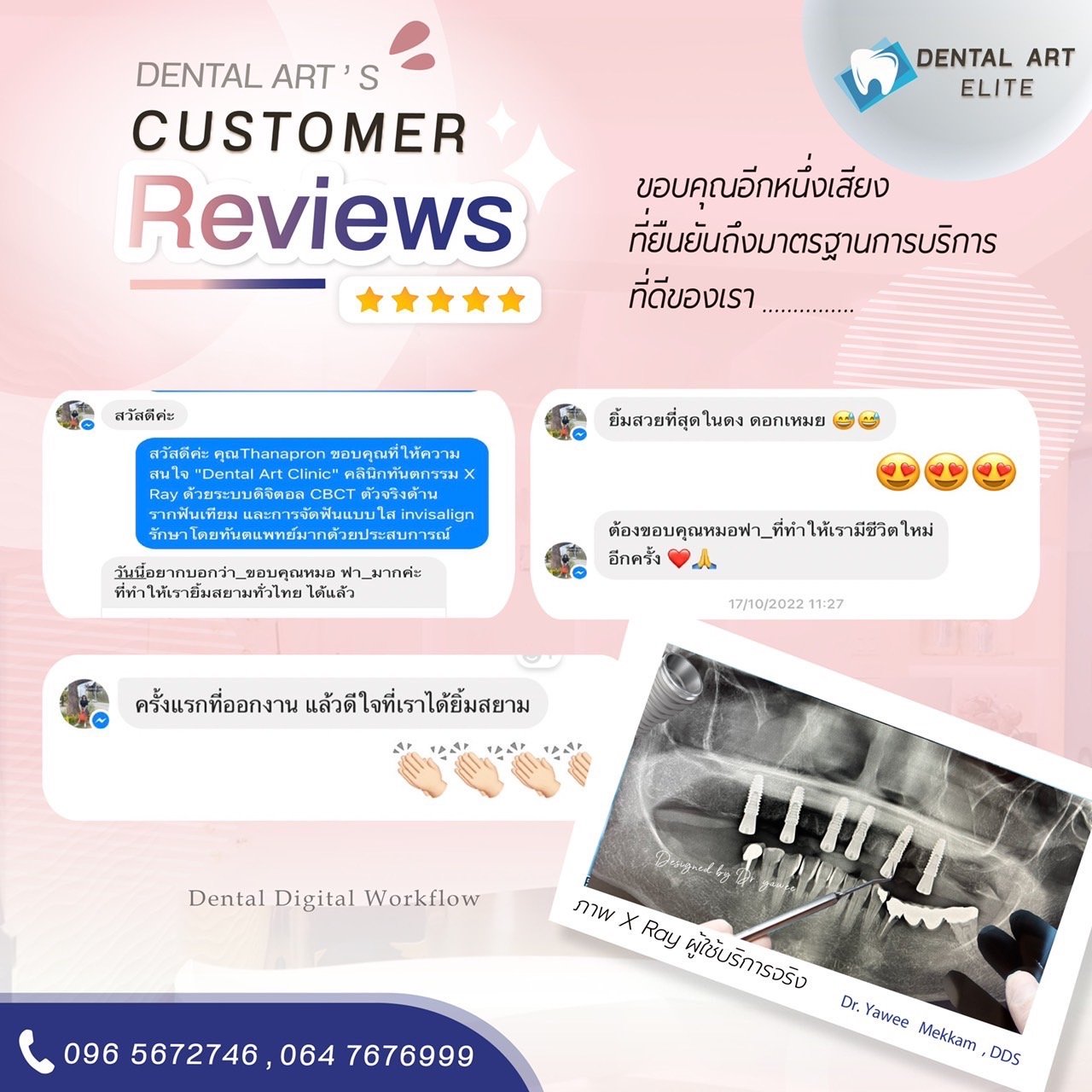 ศูนย์รากฟันเทียม จัดฟันฟันใส invisalign Dental Art Elite