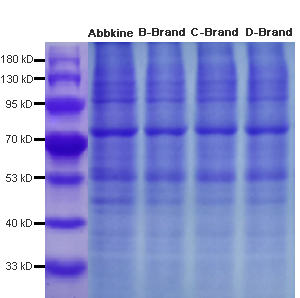 SDS-PAGE Protein Sample Loading Buffer (5X) - smartscience