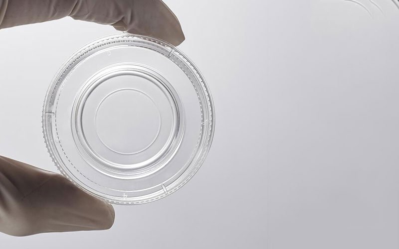 Tissue Culture Dishes, 6.0cm, Standard Type, Surface-Treated (10 pcs ...