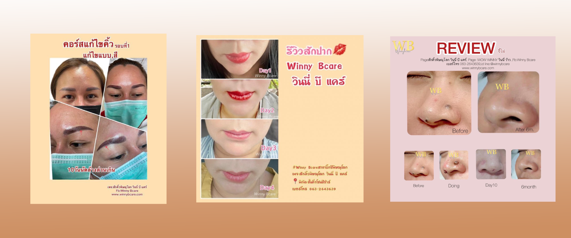Winny B care ดูแลความงามให้คุณ