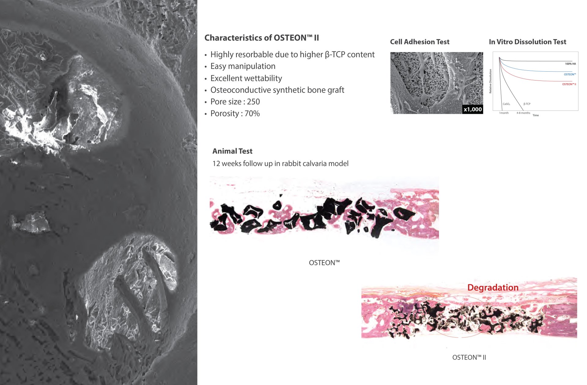 Regeneration Osteon 2 - dentiumthailand
