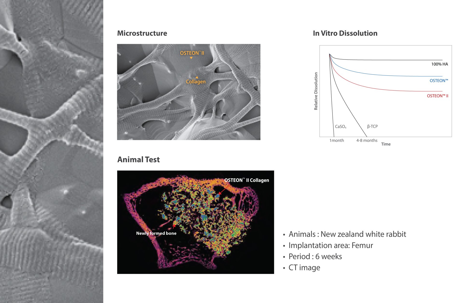 Regeneration Osteon 2 Collagen - dentiumthailand