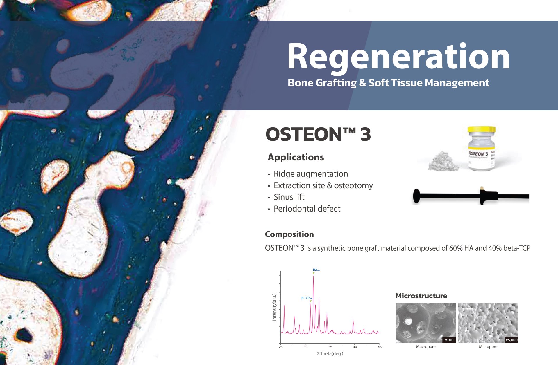 Regeneration Osteon 3 - dentiumthailand