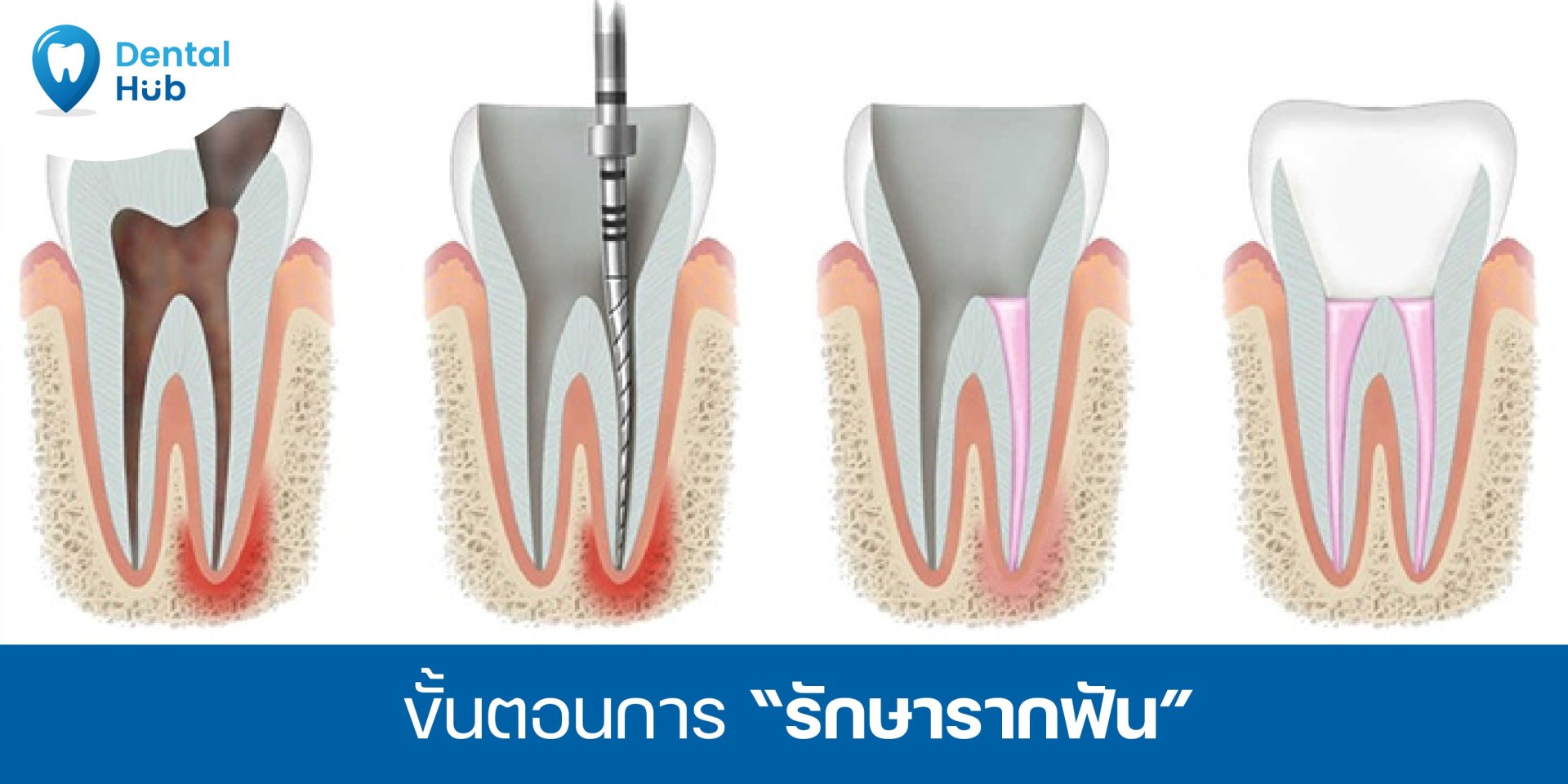 Dentalhubclinic dentalhubclinic