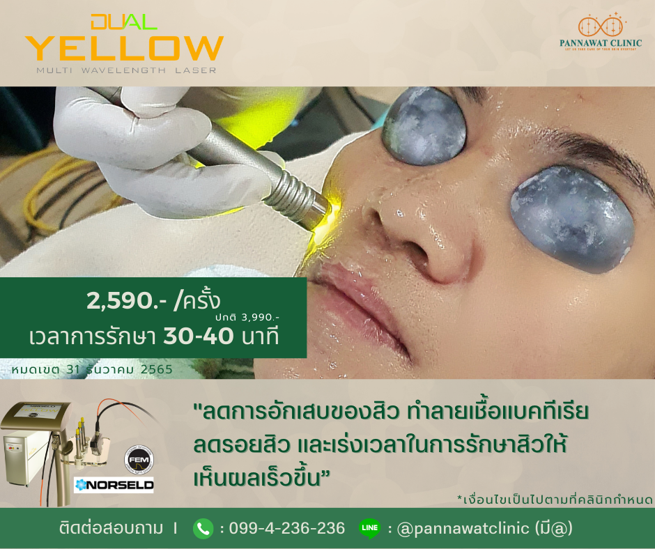 Dual Yellow - pannawat