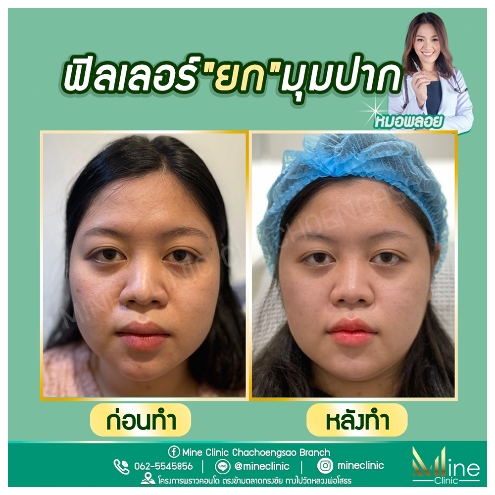 Mine Clinic คลินิกเสริมความงามและดูแลใบหน้า