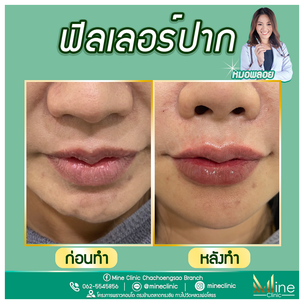 Mine Clinic คลินิกเสริมความงามและดูแลใบหน้า