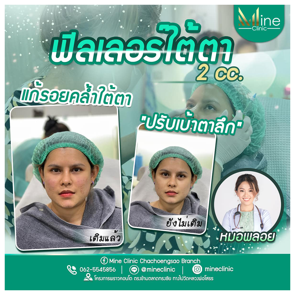 Mine Clinic คลินิกเสริมความงามและดูแลใบหน้า
