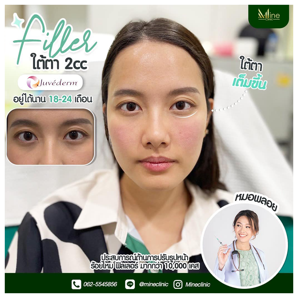 Mine Clinic คลินิกเสริมความงามและดูแลใบหน้า