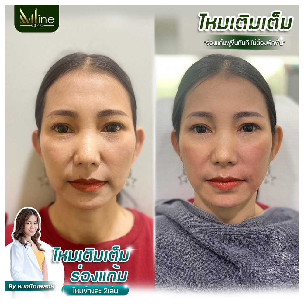 Mine Clinic คลินิกเสริมความงามและดูแลใบหน้า