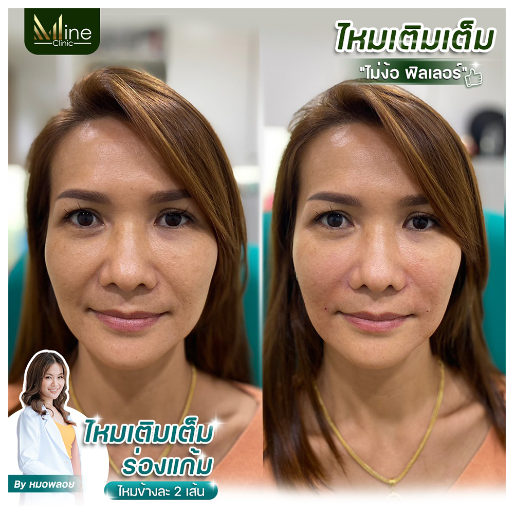 Mine Clinic คลินิกเสริมความงามและดูแลใบหน้า