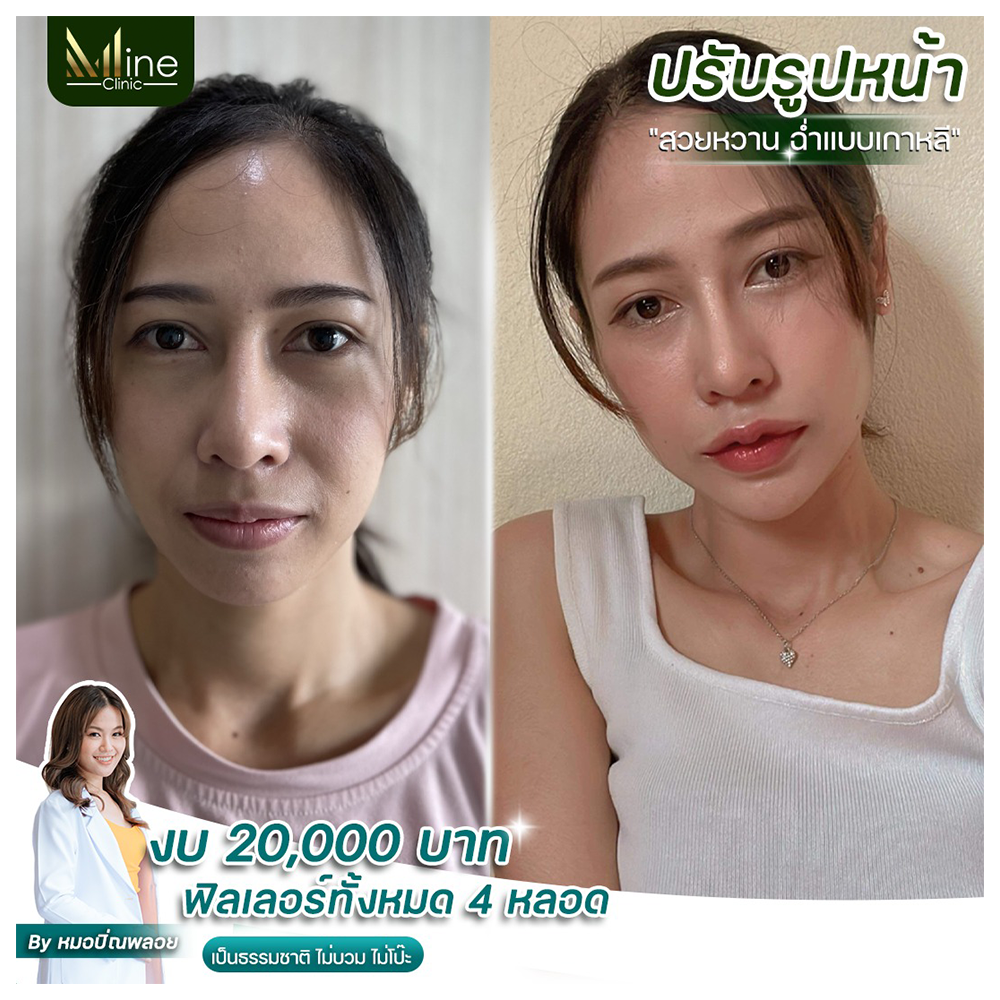 Mine Clinic คลินิกเสริมความงามและดูแลใบหน้า
