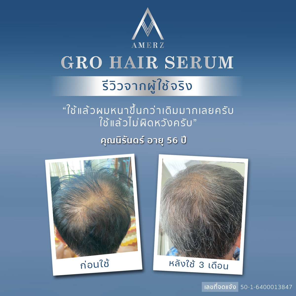 GRO HAIR SERUM - amerz