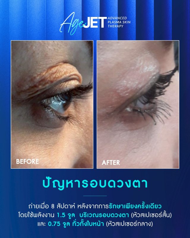 Agejet - Innowaitalab - นวัตกรรมเพื่อชีวิตที่ดีกว่า