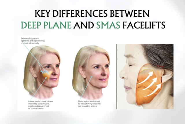 Best Face-Lift Surgery (rhytidectomy) in Thailand