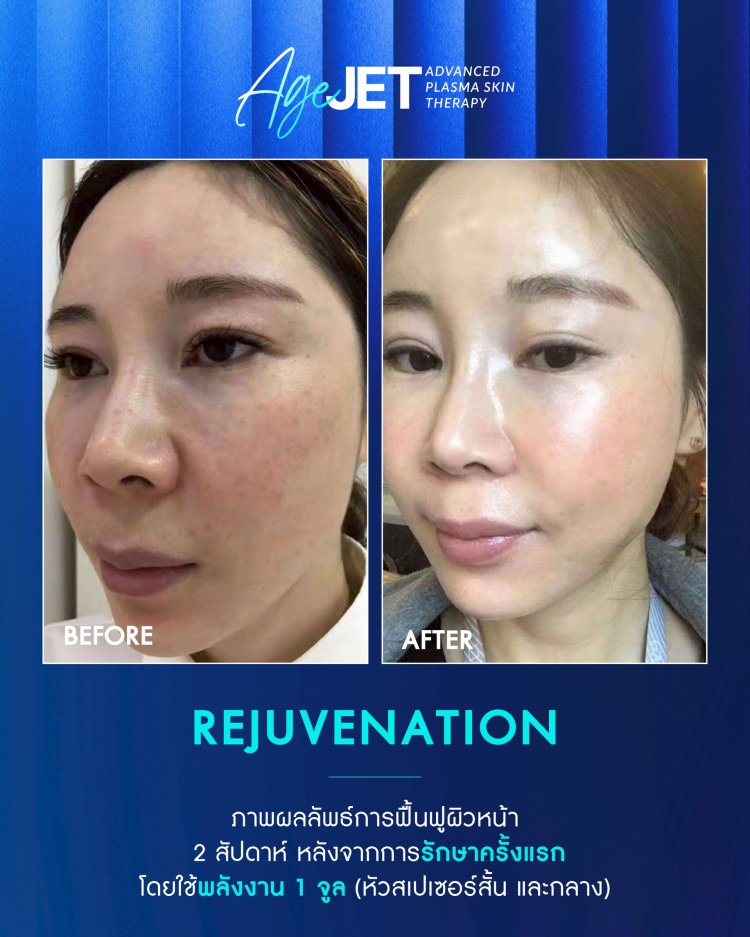 Agejet - Innowaitalab - นวัตกรรมเพื่อชีวิตที่ดีกว่า