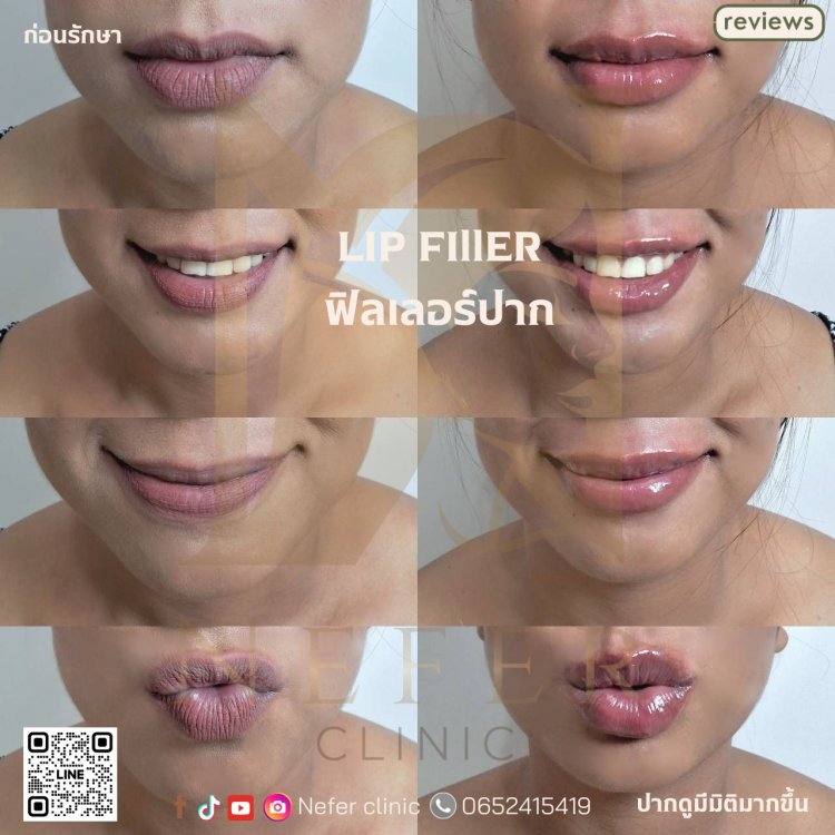 Case Review - Nefer Clinic เนเฟอร์คลินิกเวชกรรม บ้านฉาง โดยคุณหมอส้มโอ