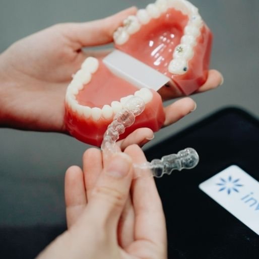 Invisalign Thailand | Clear Aligners Guide & Comparison